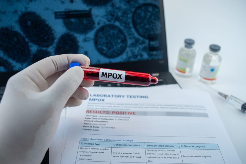 OMS mantiene la alerta por la epidemia de mpox y pide apoyo