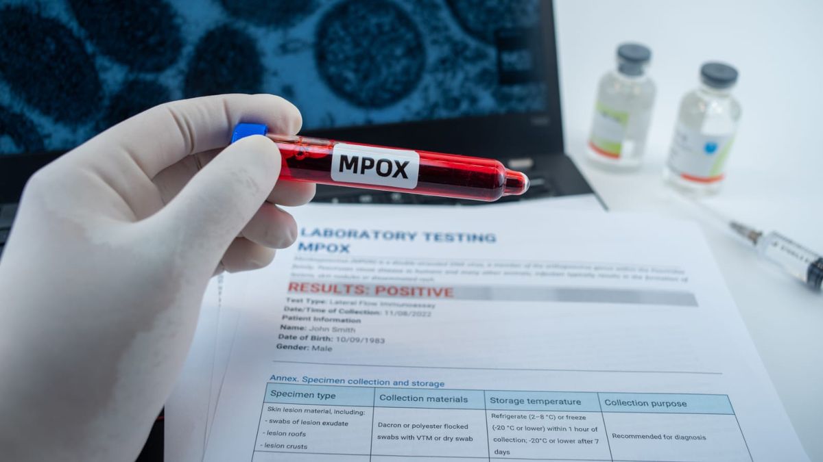 OMS mantiene la alerta por la epidemia de mpox y pide apoyo