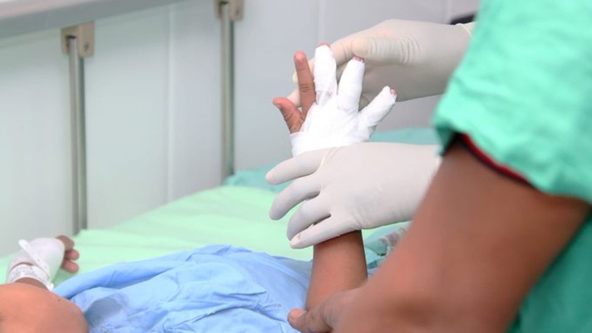 Minsa refuerza la campaña No más niños quemados